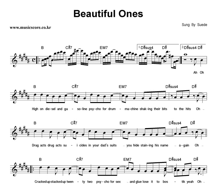 Suede Beautiful Ones 악보